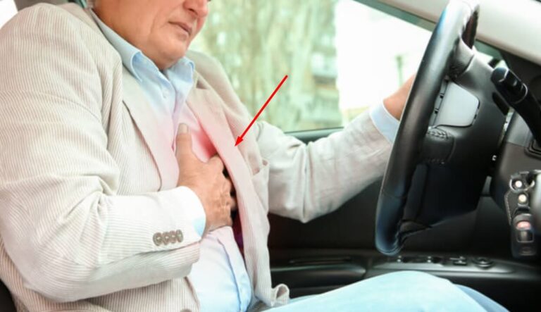 Dashboard Injuries: Risks, Treatment, and Recovery - Comprehensive ...